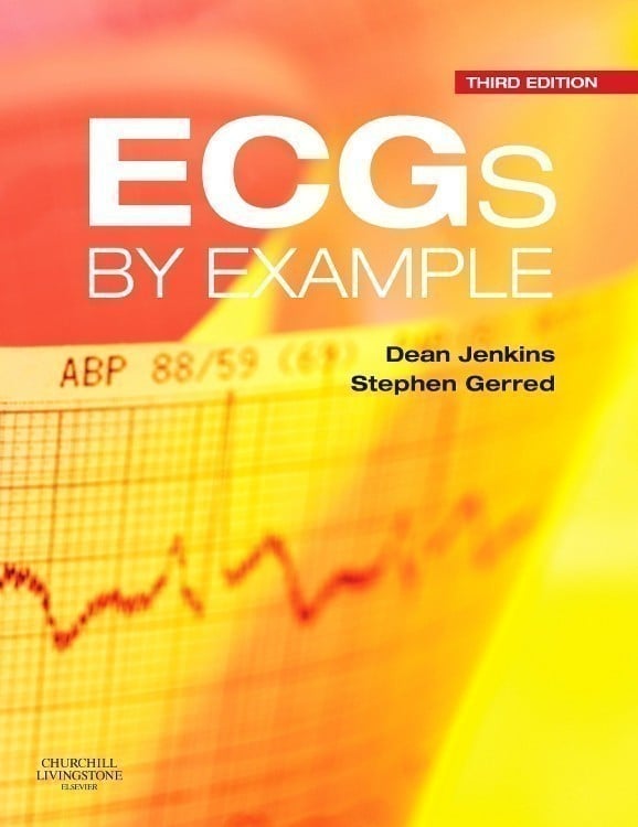 Physiotherapy & Medical Books > ECGs by Example. Edition: 3