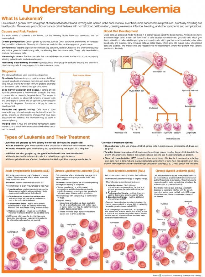 Anatomy Charts & Posters > Understanding Leukemia Anatomical Chart ...